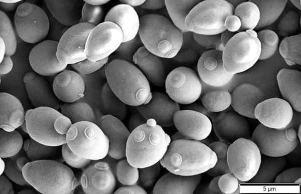Genetically Engineer Yeast to be Fluorescent | Science Project